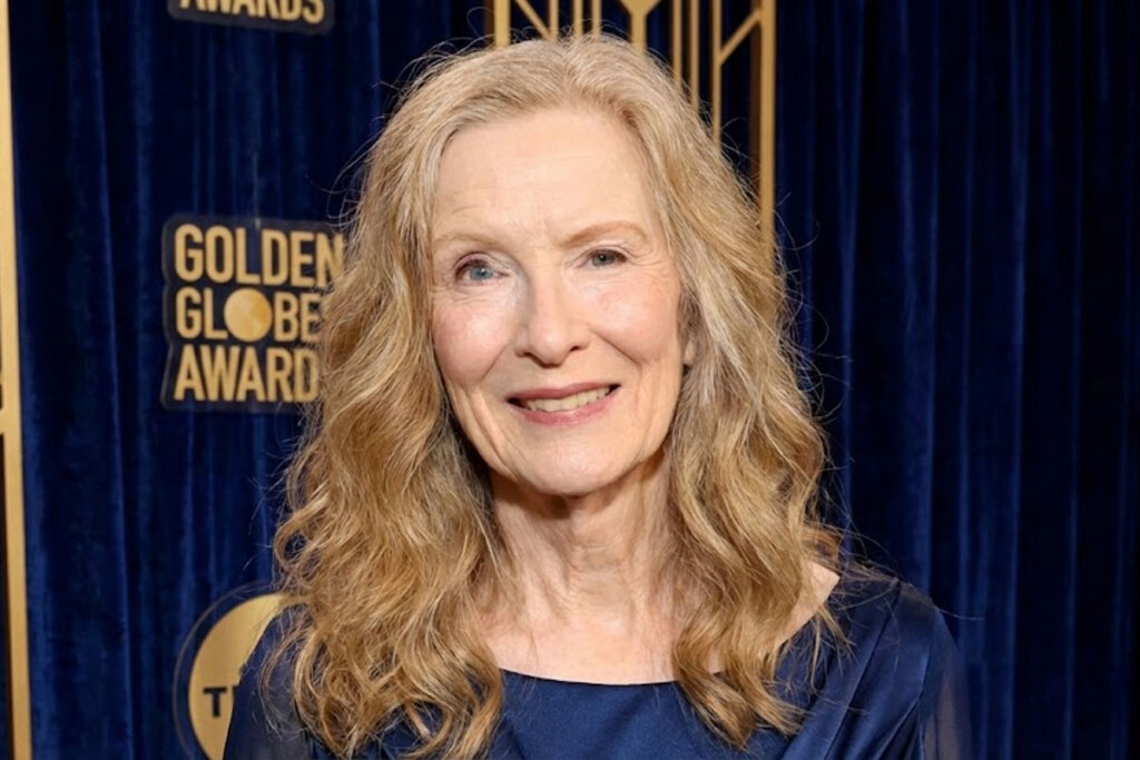 Frances Conroy's Eye: The Real Story Behind Her Cloudy Eye